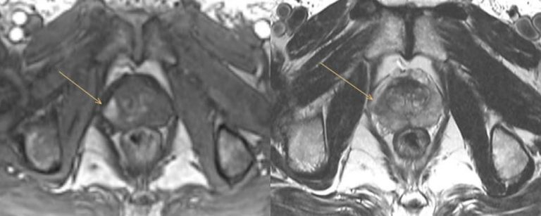 Prostata-MRT Stuttgart - Radiologische Praxis am Diakonie-Klinikum
